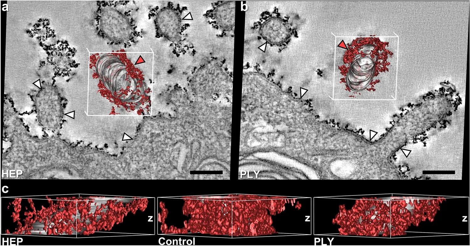 The unremarkable alveolar epithelial glycocalyx: a thorium dioxide ...