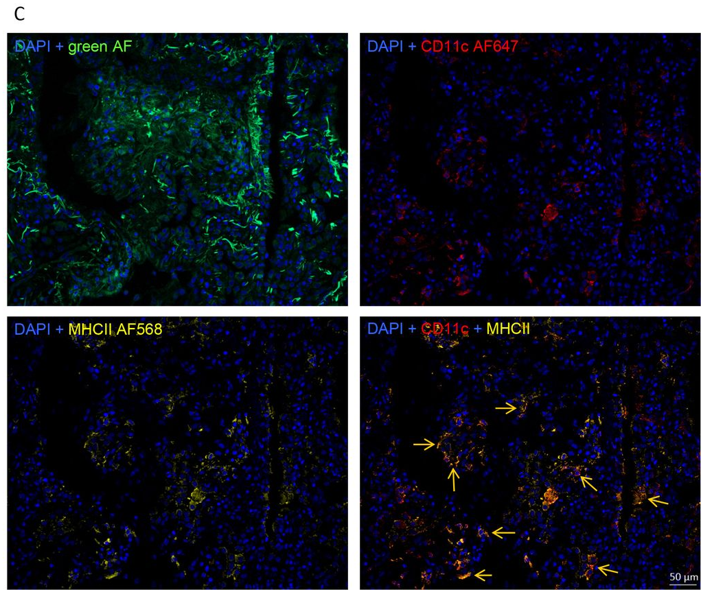 The FMS-like tyrosine kinase-3 ligand/lung dendritic cell axis ...