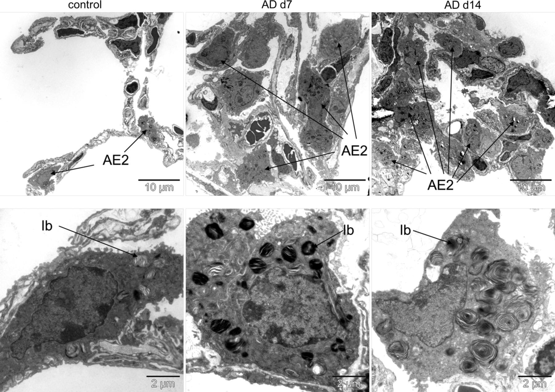 Linking progression of fibrotic lung remodeling and ultrastructural ...