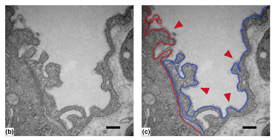 Comparative electron microscopic visualization of the lung alveolar ...